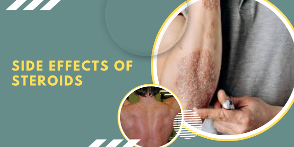 What are the best foods to eat while taking steroids? - UK Steroids Store